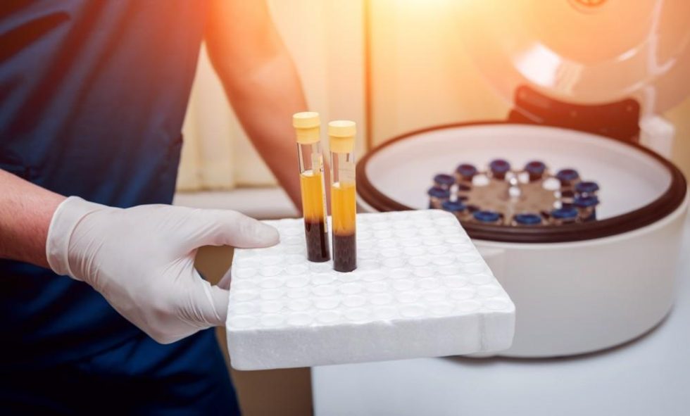 How Does PRP Work? - Tadje Ortho